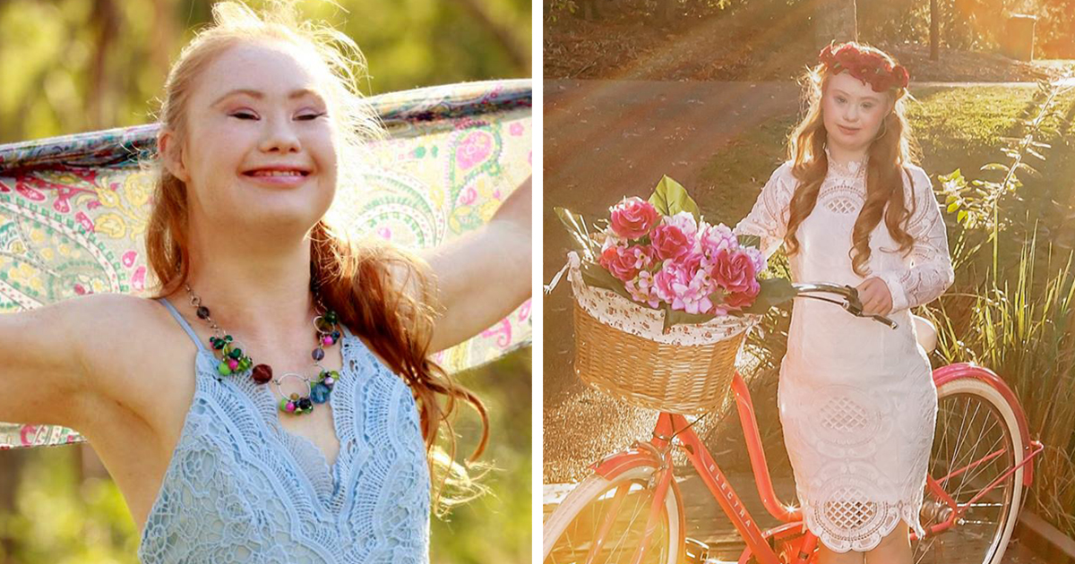 Maddy har Downs syndrom og har blitt modell. Nå inspirerer hun ...